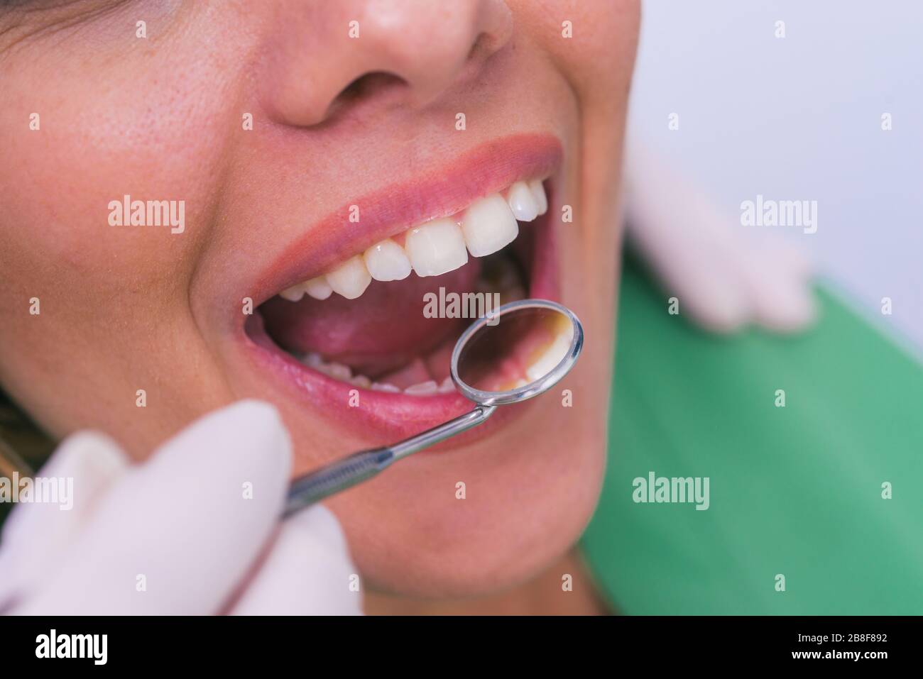 Closeup of a female patient with an open mouth during oral checkup at ...