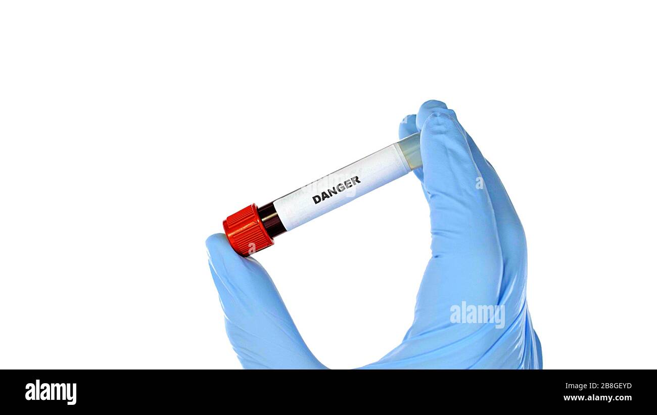Blood test hand hi-res stock photography and images - Alamy