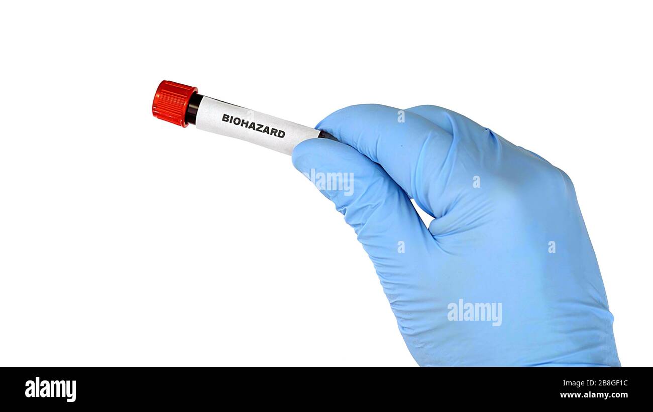 Blood test hand hi-res stock photography and images - Alamy