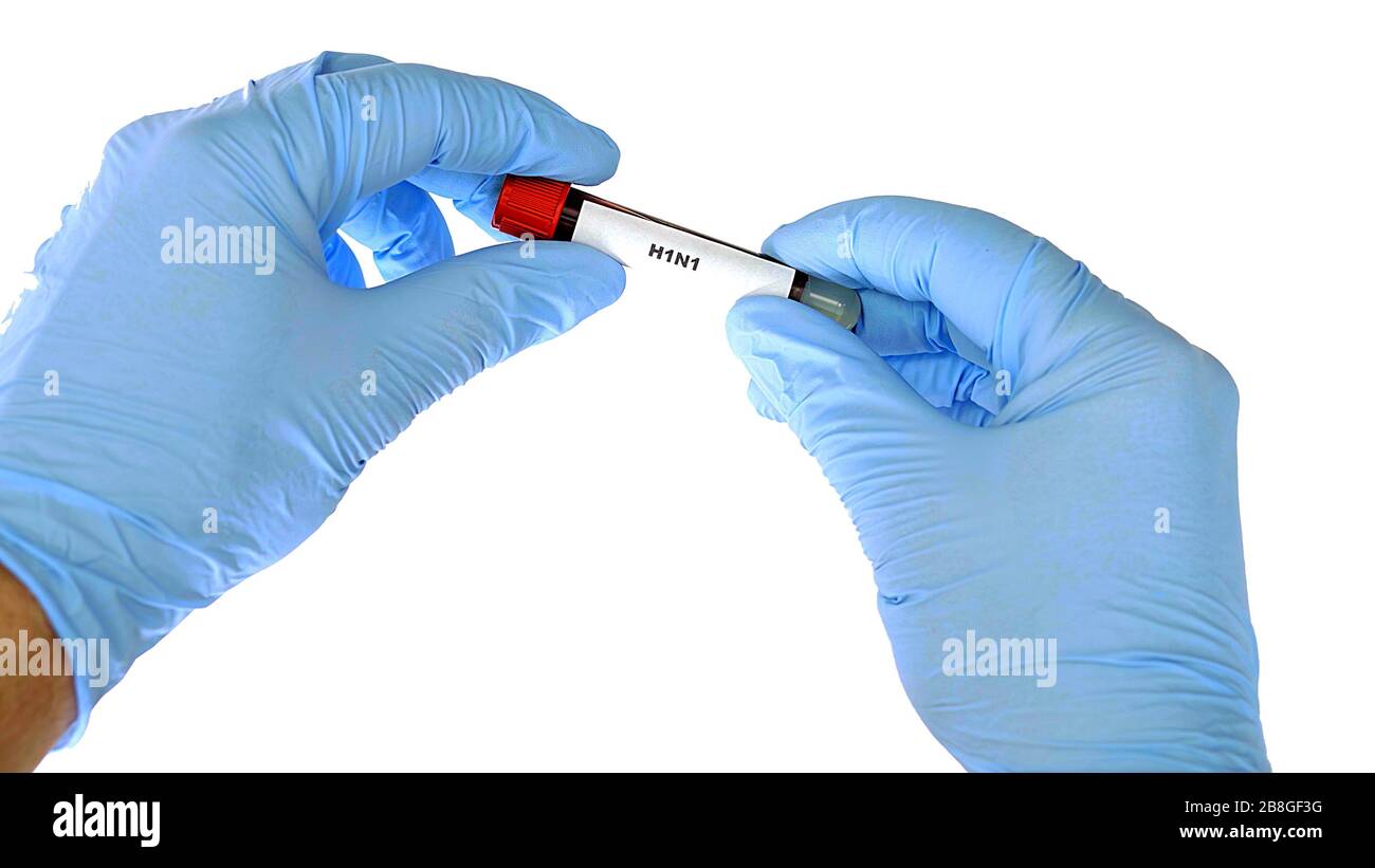 The concept of a blood test. Hands in gloves, keep medical tube with ...