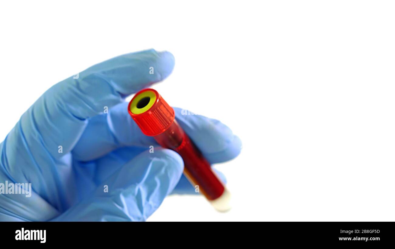 Hands in blue gloves, keep medical tube with real blood. Isolated on a ...