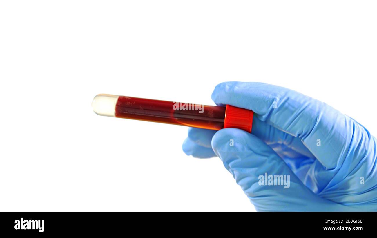 Real Blood High Resolution Stock Photography and Images - Alamy