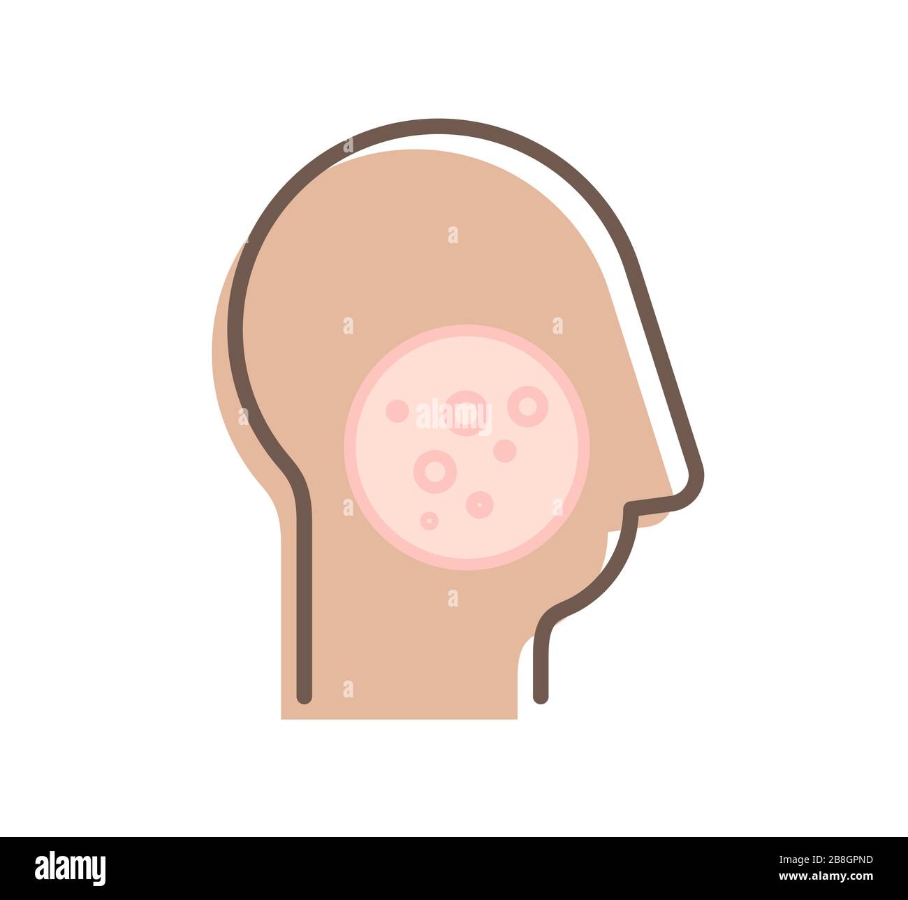 Skin Allergy - Icon as EPS 10 File Stock Vector Image & Art - Alamy