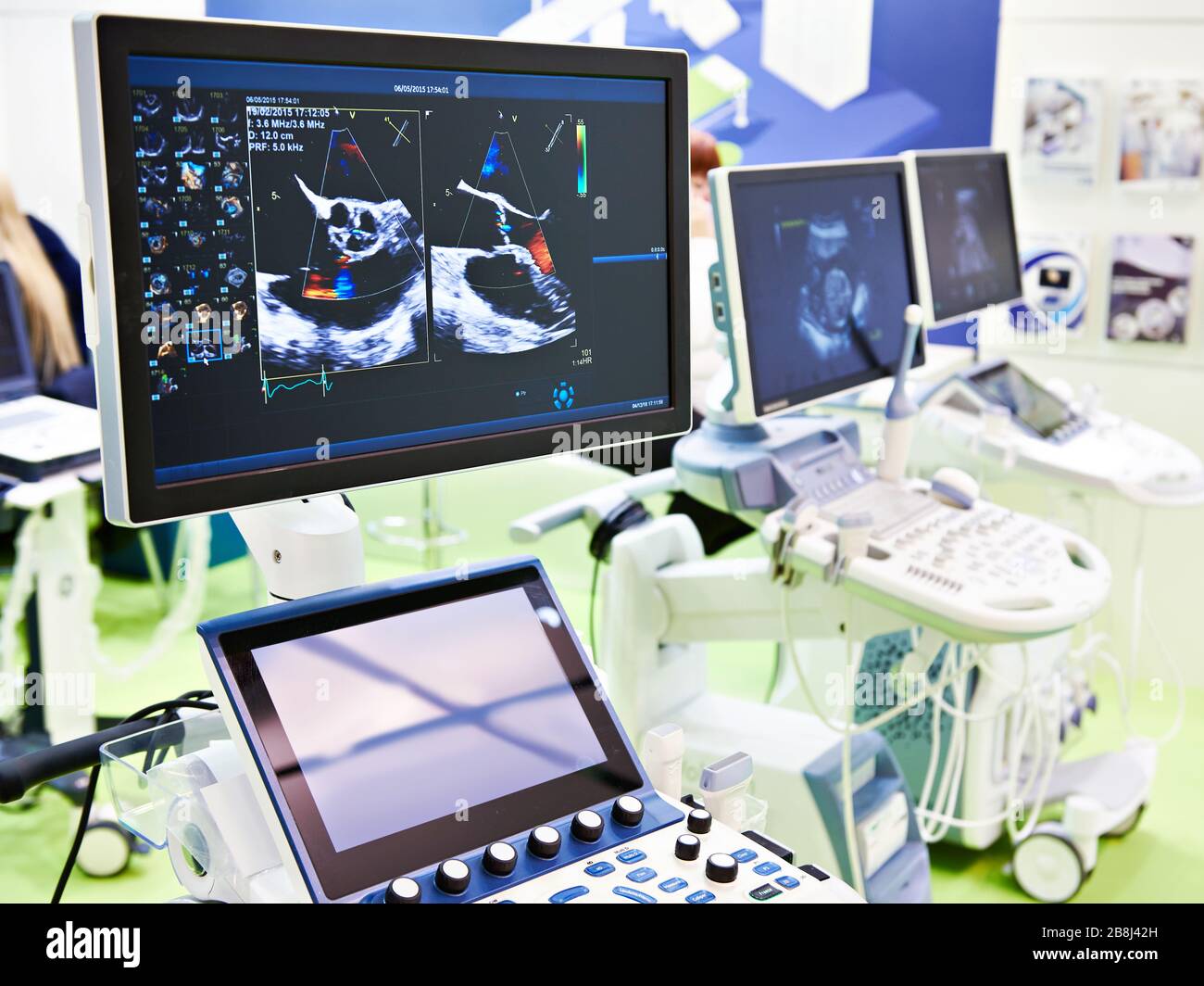 Ultrasound screen hi-res stock photography and images - Alamy