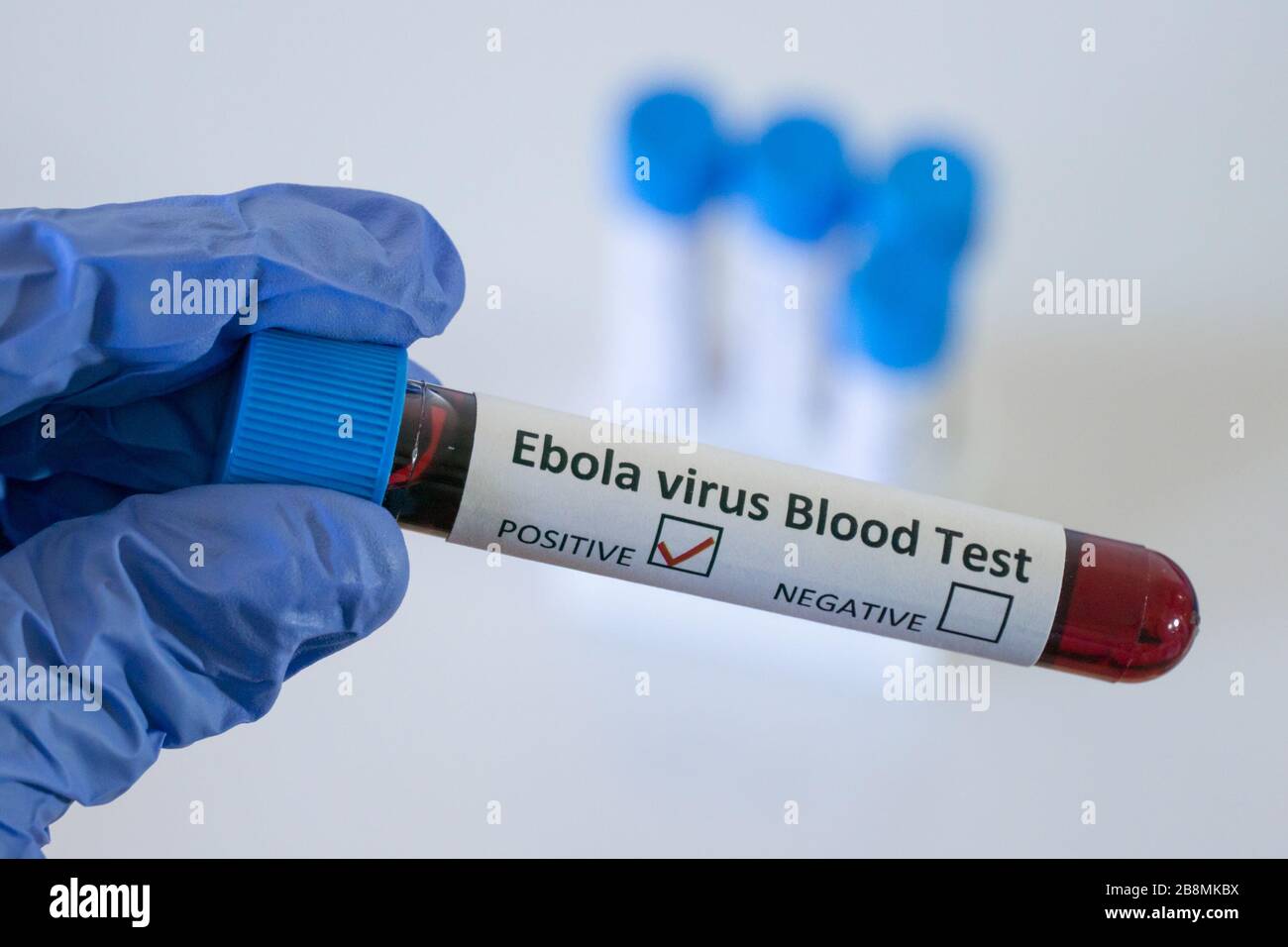 Viral disease hi-res stock photography and images - Alamy