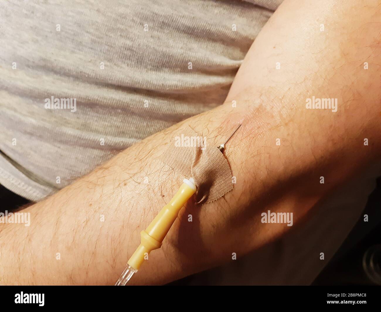 Close-up photo of male hand with a dropper inserted into a vein Stock ...