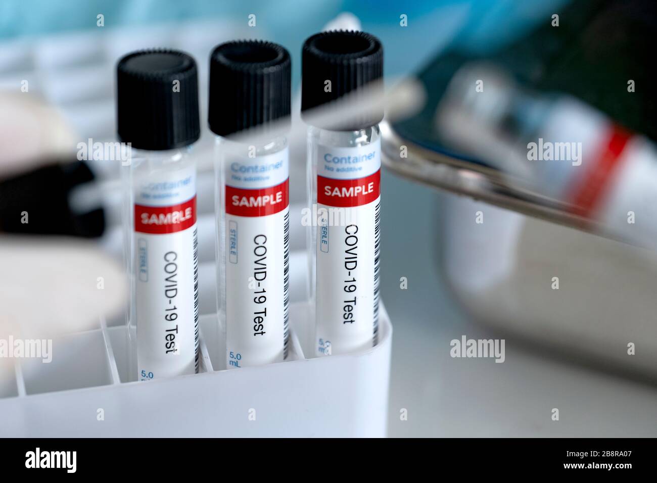 Multiple swab samples testing for COVID-19. Coronavirus pandemic tests ...