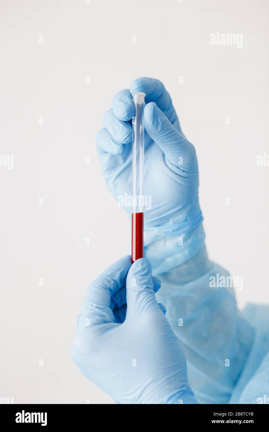 Close up of doctor hand holding blood sample. Medical equipment. Blood ...