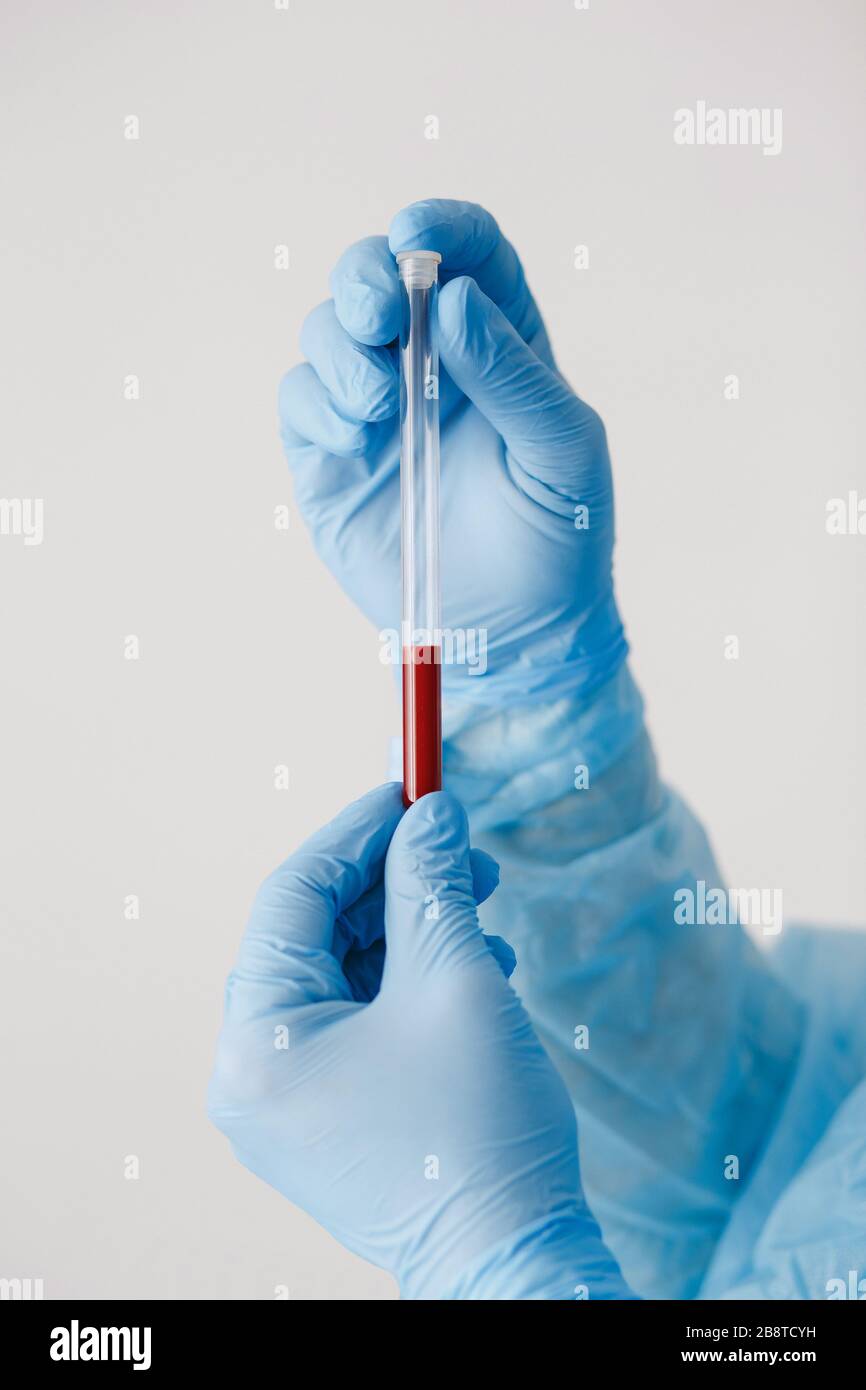 Close up of doctor hand holding blood sample. Medical equipment. Blood ...