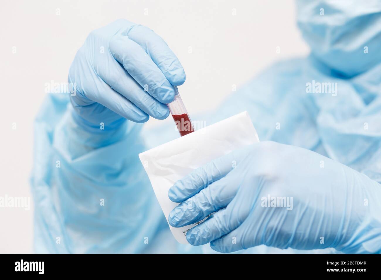 Close up of doctor hand holding blood sample. Medical equipment. Blood ...