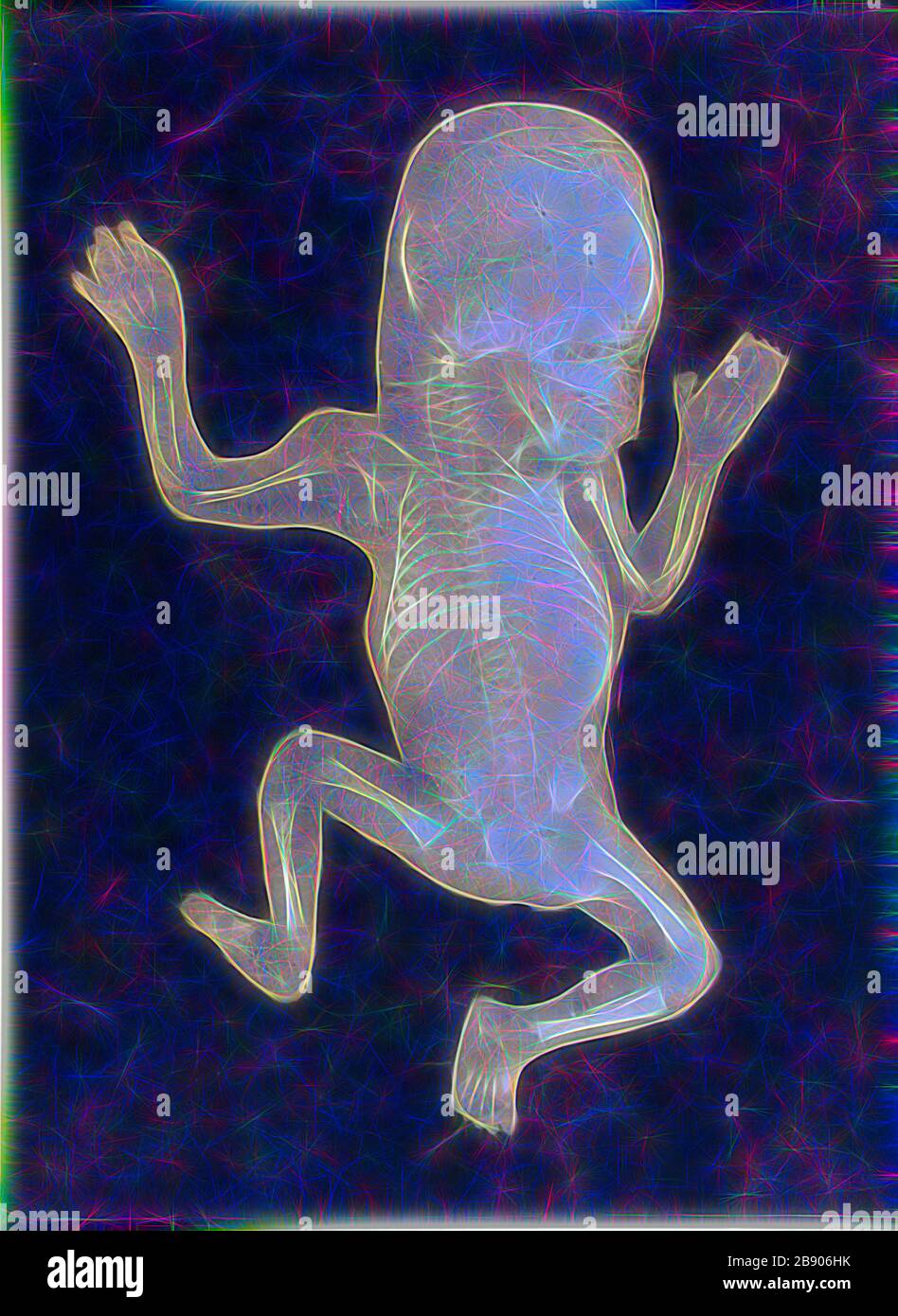 3 month fetus hi-res stock photography and images - Alamy