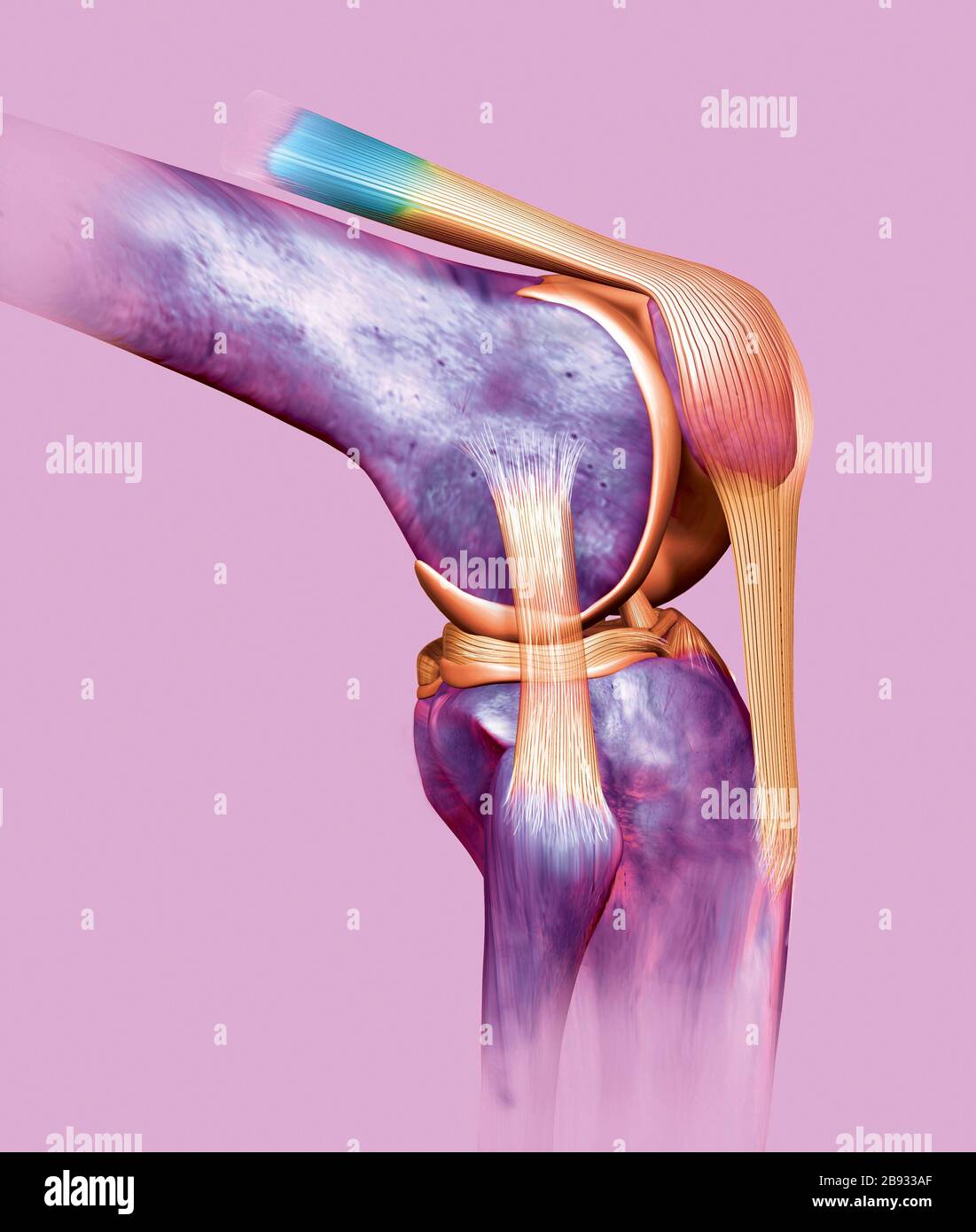 Accurate medically 3D illustration showing painful knee joint with ...