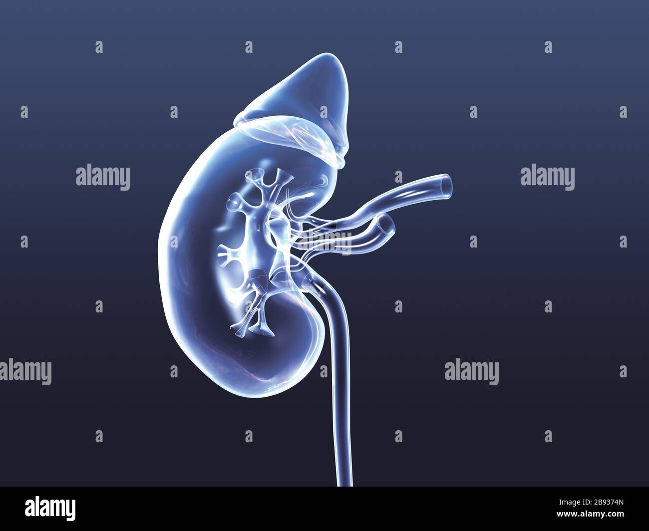 Kidney ureter x ray hi-res stock photography and images - Alamy