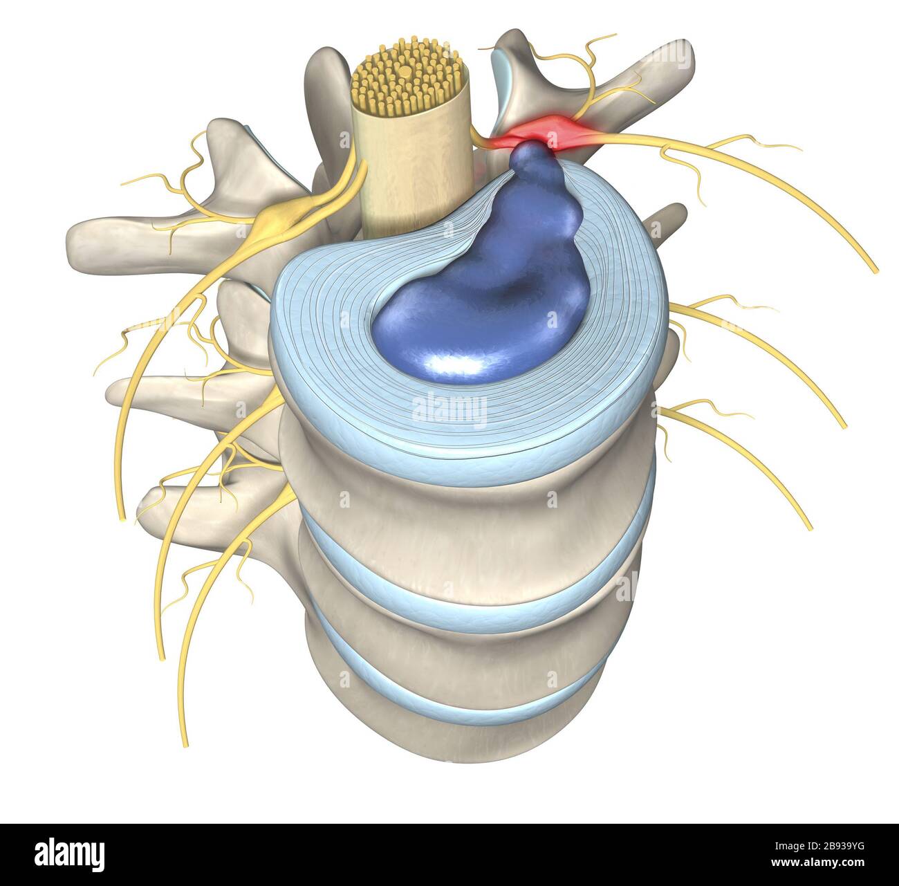 What Is A Herniated Disc In A Dog