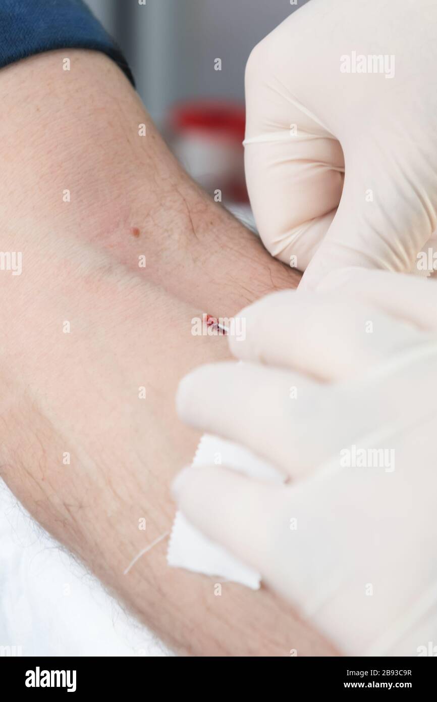 Mobile blood transfusion station hi-res stock photography and images ...