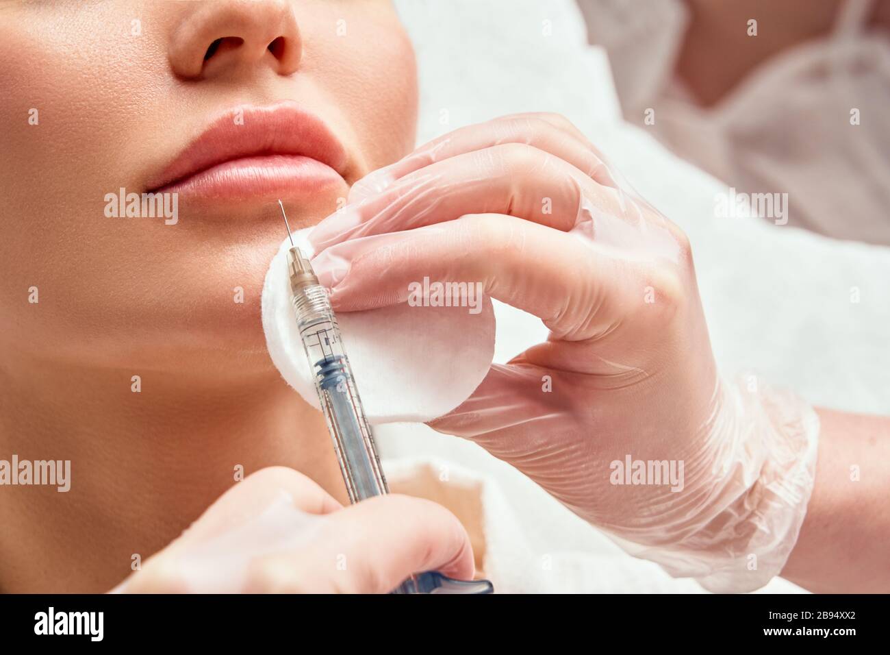 lip shape correction procedure in a cosmetology salon. The specialist ...