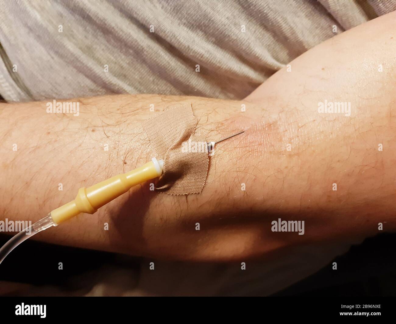 Patient has an intravenous drip inserted into arm hi-res stock ...