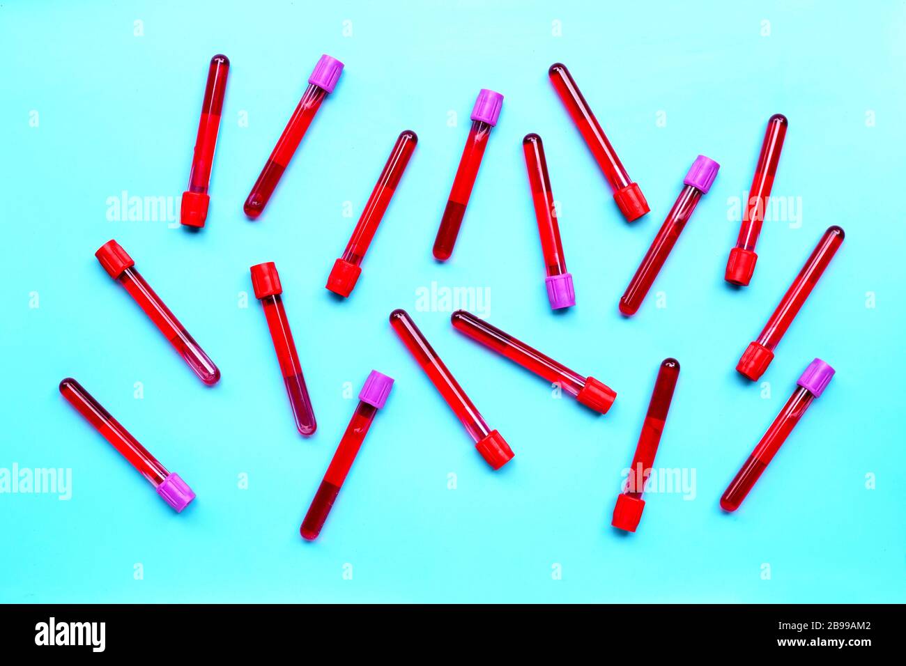 Blood in test tubes on blue background. Top view Stock Photo - Alamy