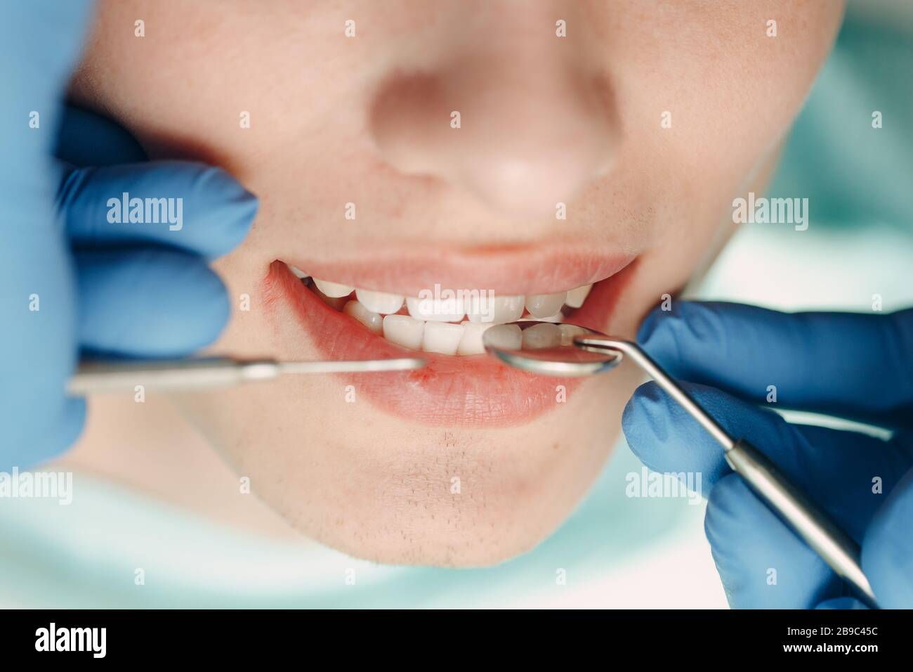 Dentistry. Dentist and patient. Dental clinic. Close up teeth Stock ...