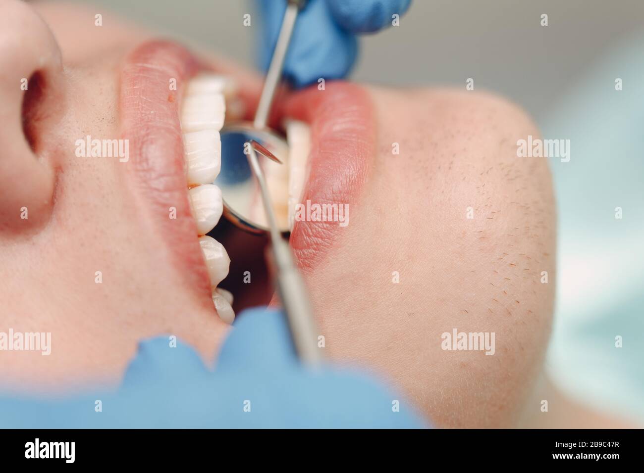 Dentistry. Dentist and patient. Dental clinic. Close up teeth Stock ...