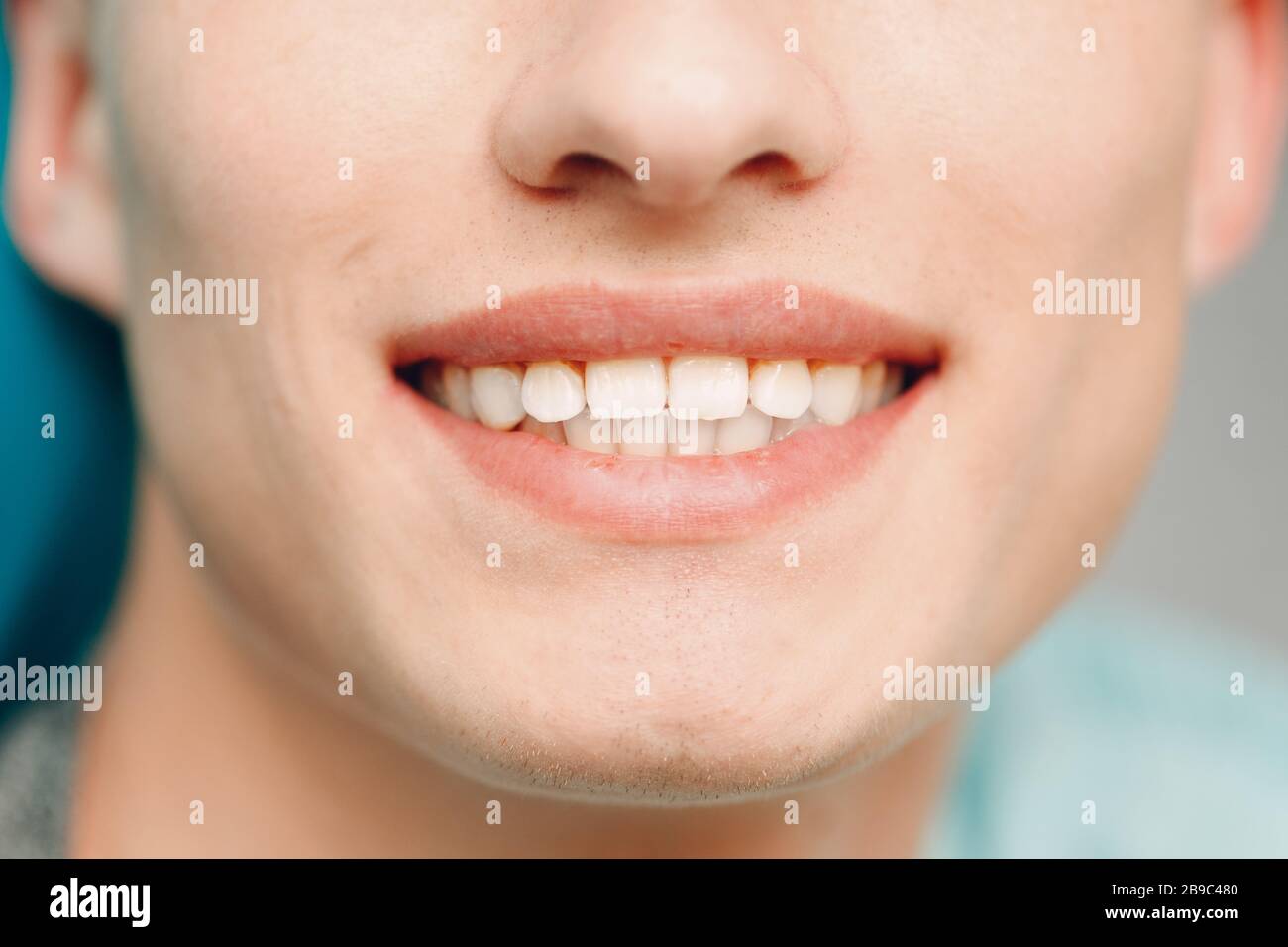 Dentistry. Dentist and patient. Dental clinic. Close up teeth Stock ...