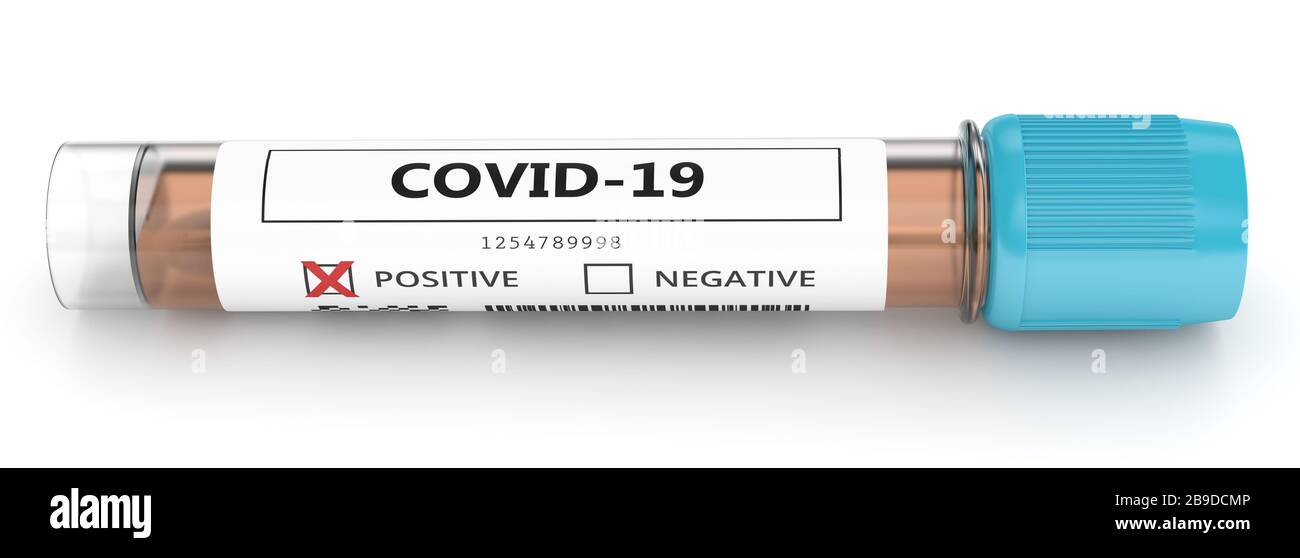 3d render of covid-19 positive nasal swab laboratory test over white ...