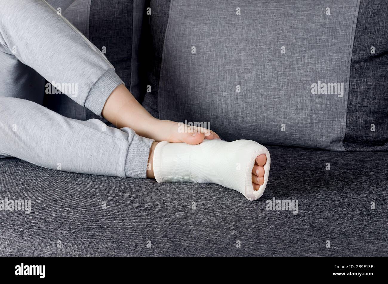 Close up of a leg young girl fiberglass. Child with Plaster bandage on ...
