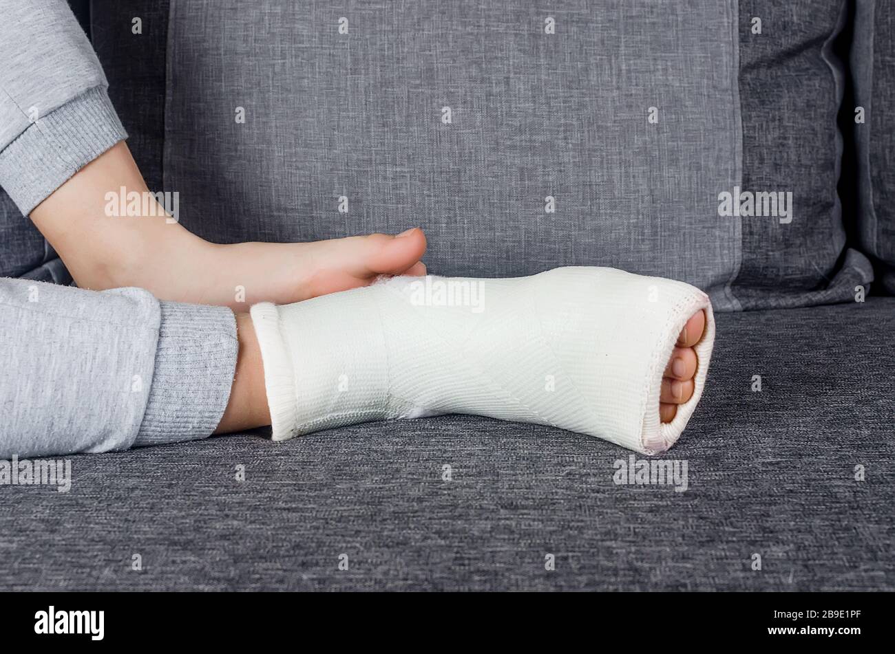 Close up of a leg young girl fiberglass. Child with Plaster bandage on ...