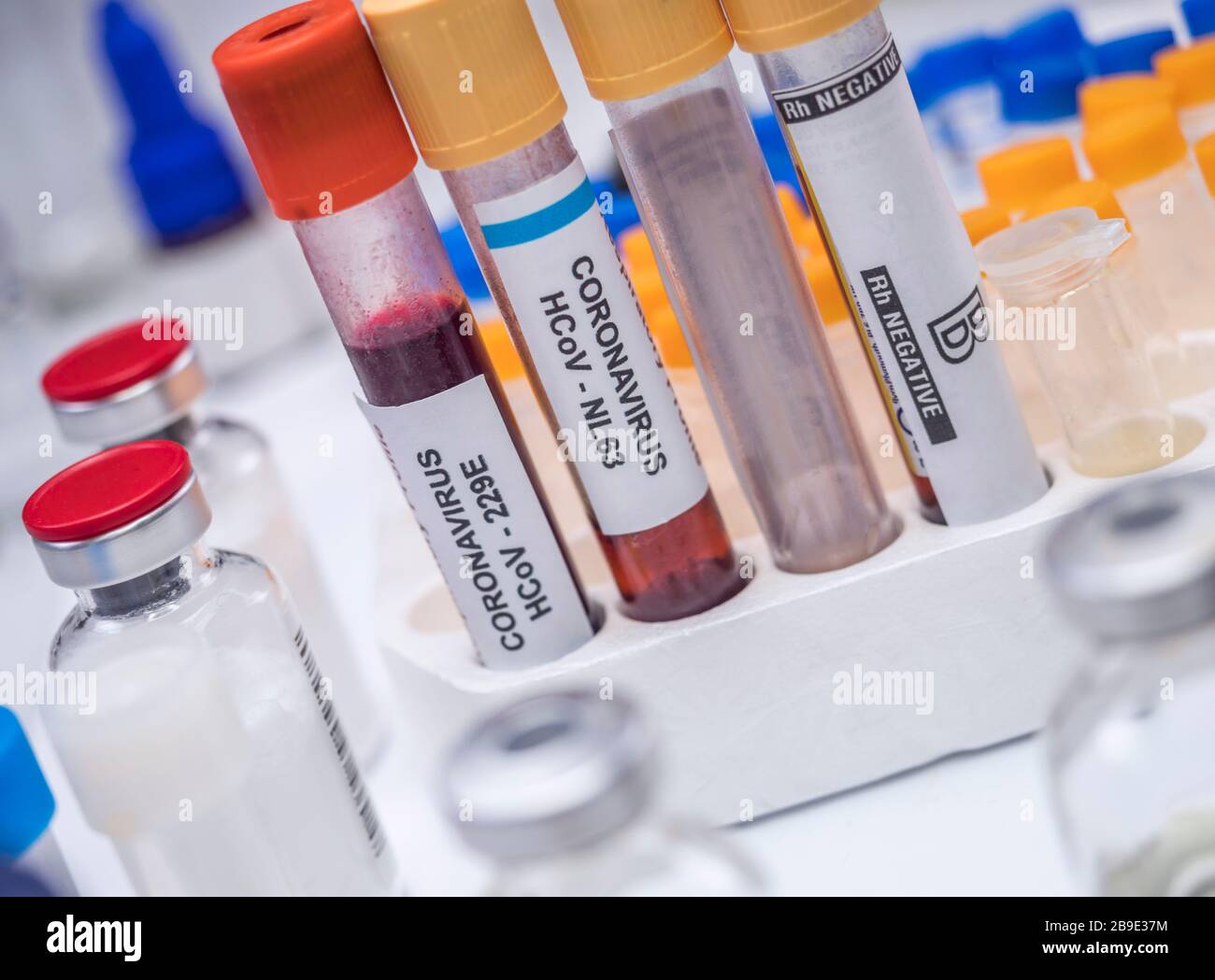 coronavirus sample in laboratory, concept image Stock Photo - Alamy