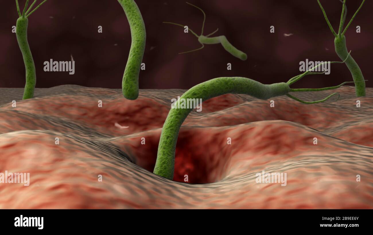 Helicobacter pylori hi-res stock photography and images - Alamy