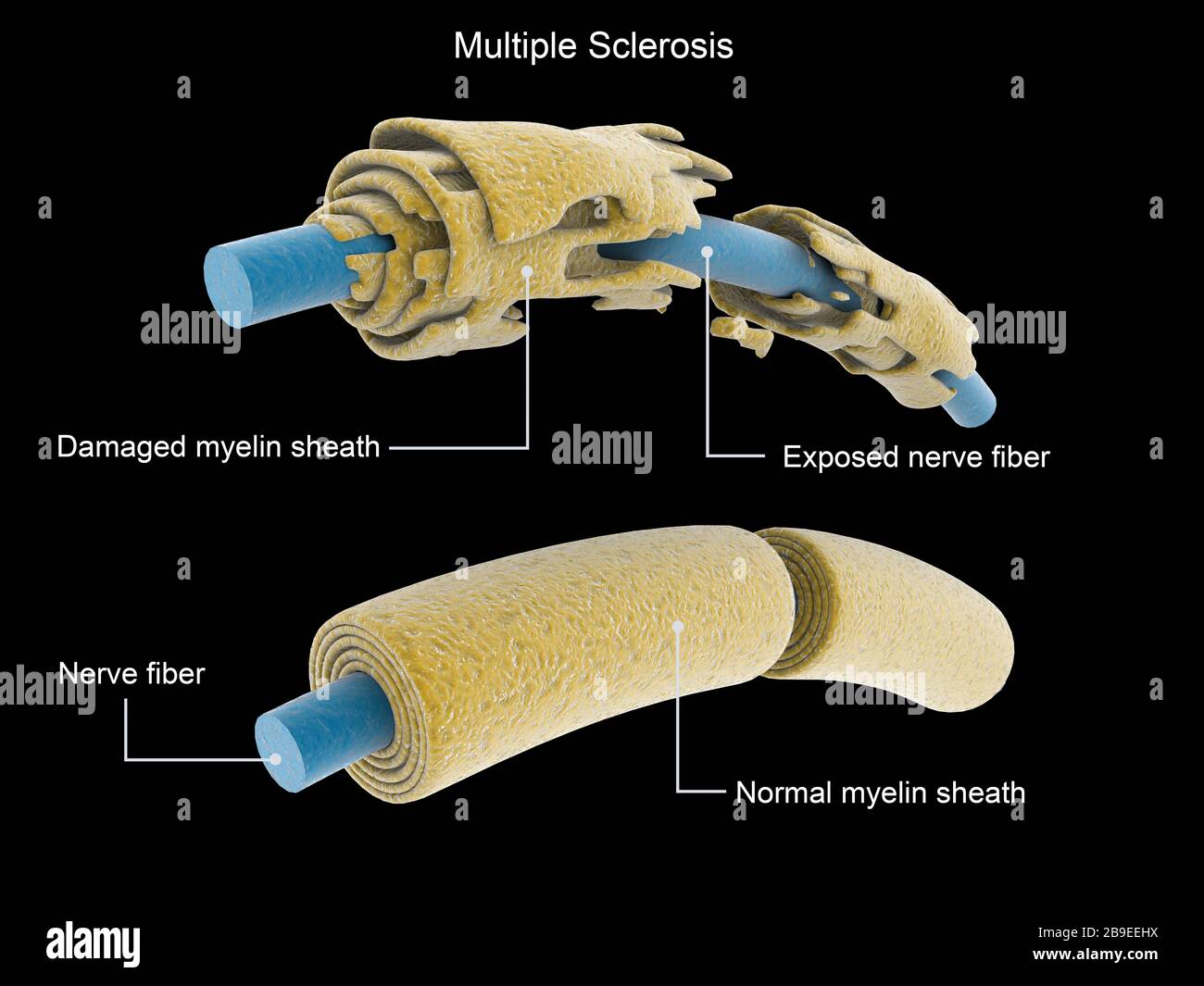 Nerve cell artwork science hi-res stock photography and images - Alamy