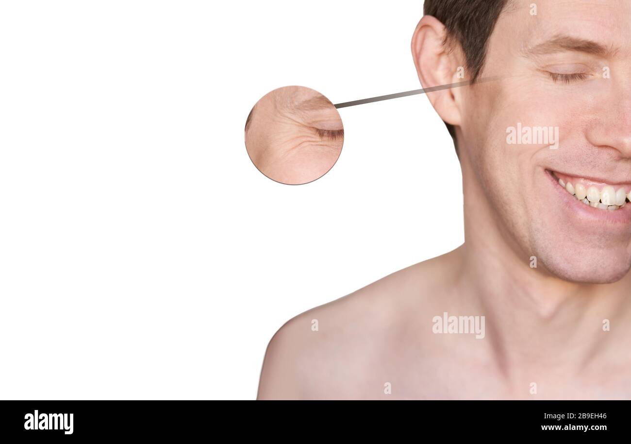 Before after effect anti hi-res stock photography and images - Alamy