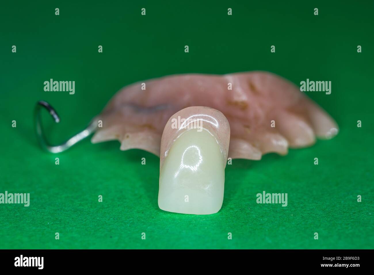 Upper jaw prosthesis with dentures Stock Photo - Alamy