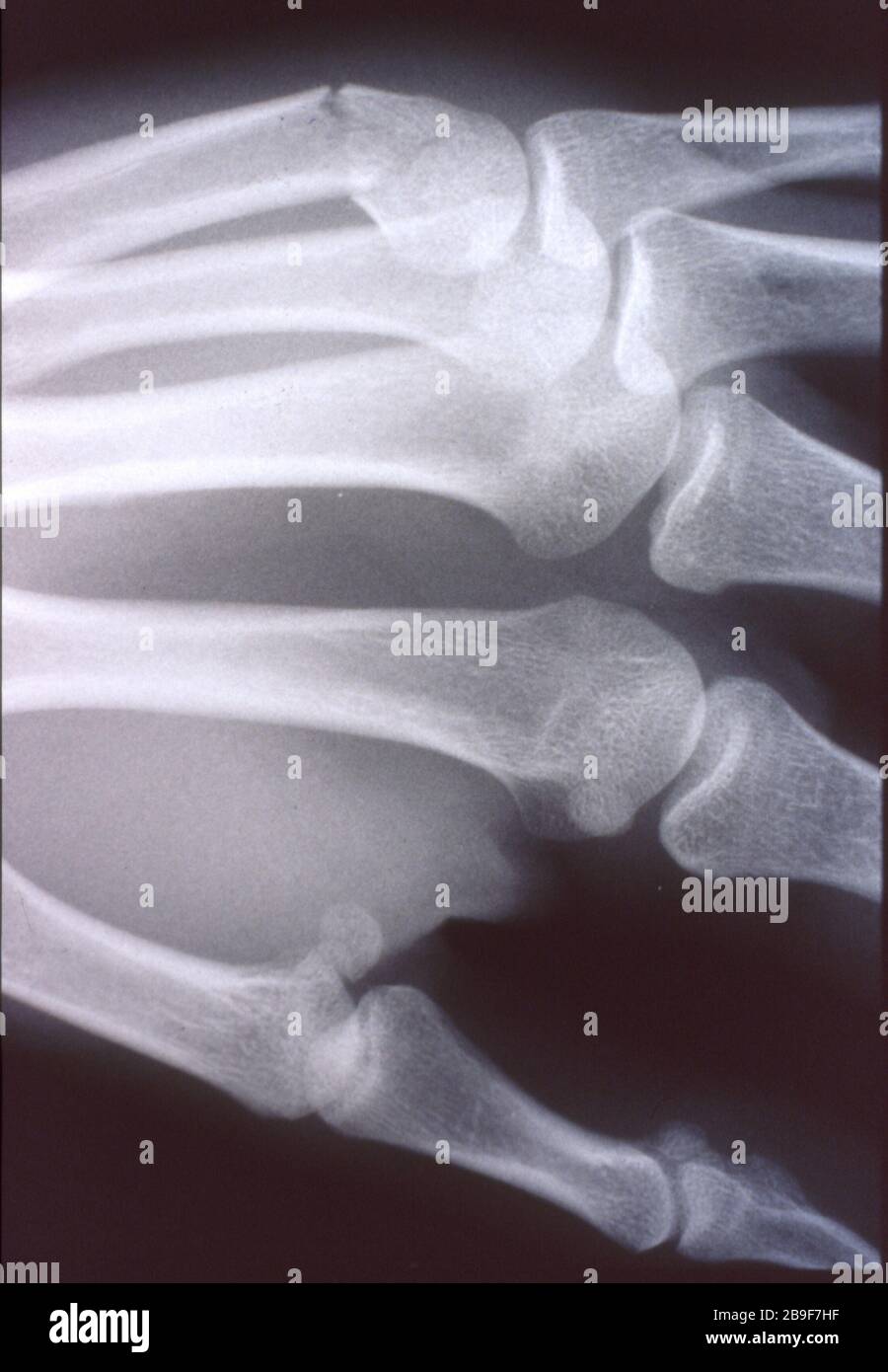 X-ray image, man, hand with bones and joints Stock Photo - Alamy