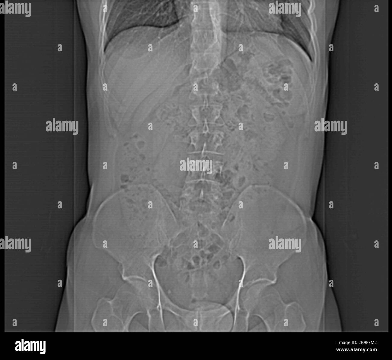 Abdomen human, man, CT scan Stock Photo - Alamy