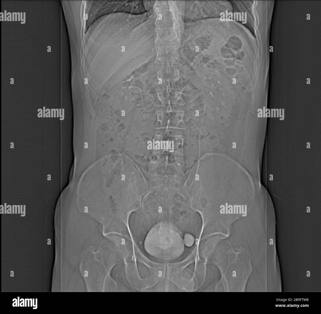 Abdomen human, man, CT scan Stock Photo - Alamy