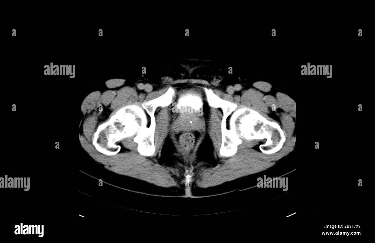 Abdomen human, man, CT scan Stock Photo - Alamy