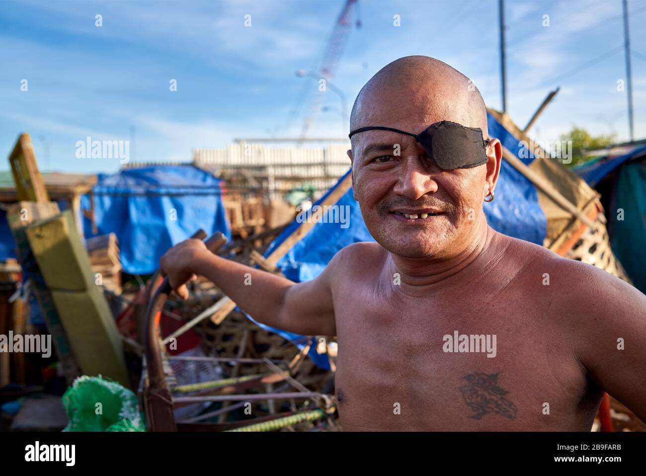 Portrait of a garbage collector with an eye patch in the streets of the ...