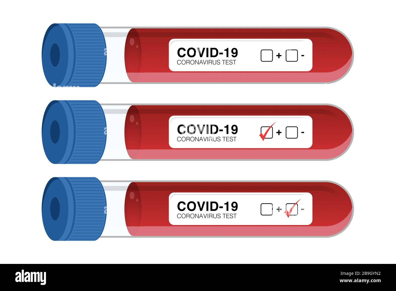 Coronavirus (Covid-19) test tube empty, positive and negative. Blood ...