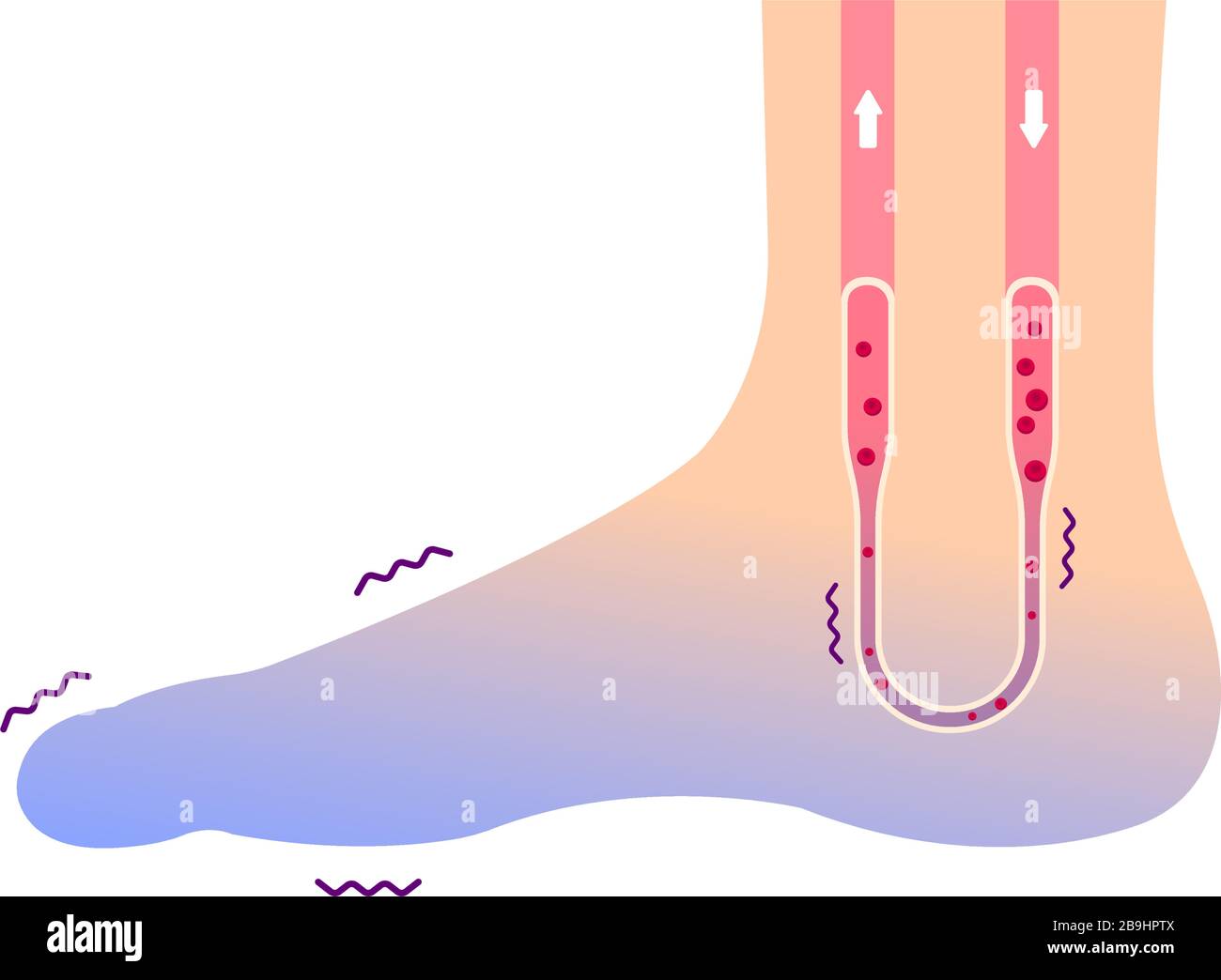 Cold foot blood circulation illustration (sensitivity to cold, cold ...