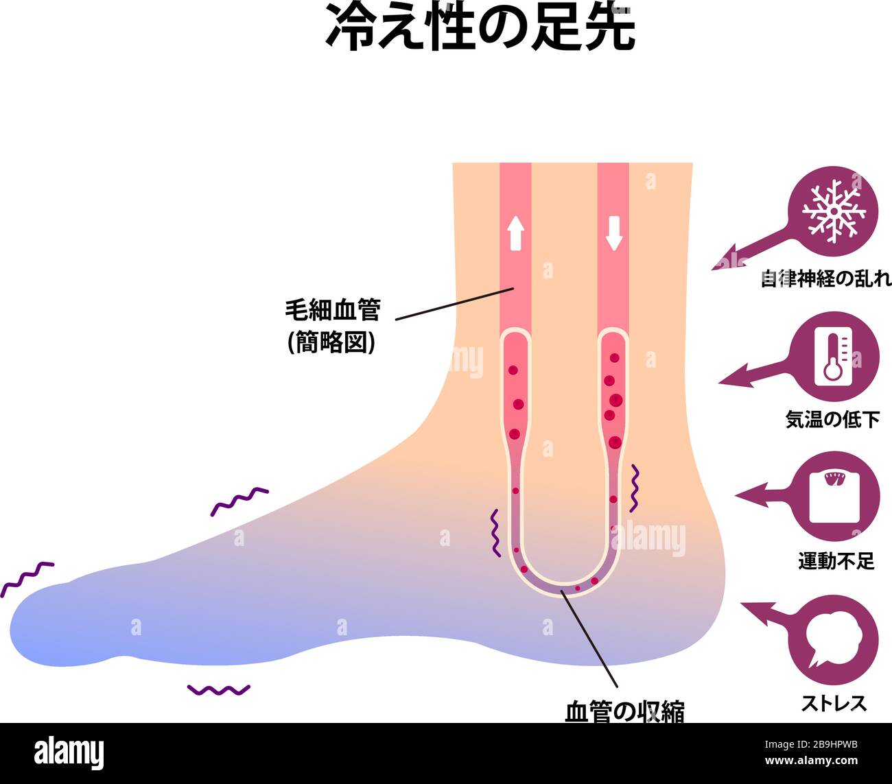 Cold foot blood circulation illustration (sensitivity to cold, cold ...
