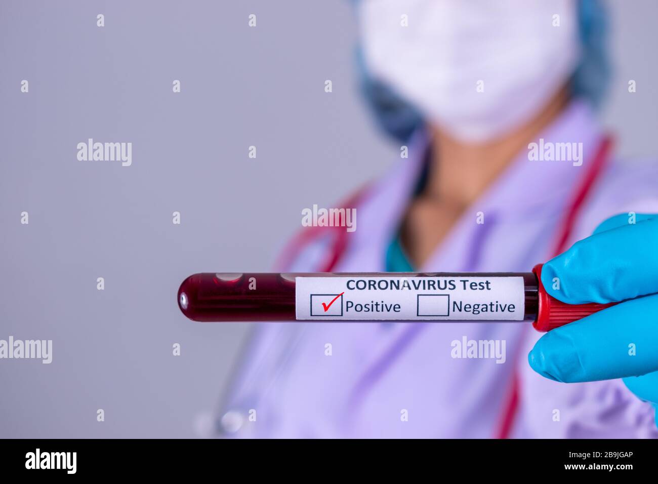 Positive COVID-19 test and laboratory sample of blood testing for ...