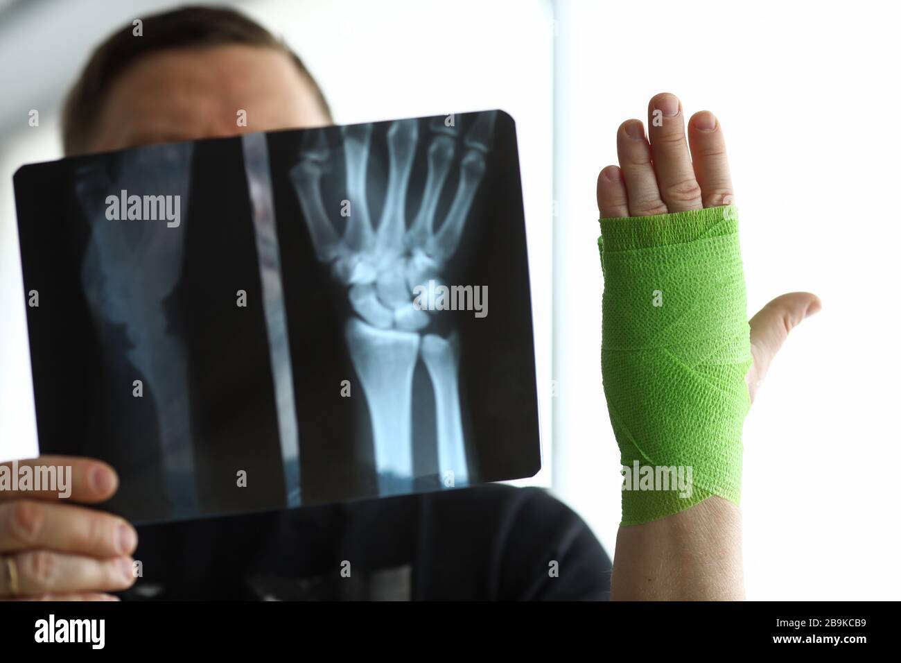 Male patient hold in hand CT scan of his broken arm at doctor ...