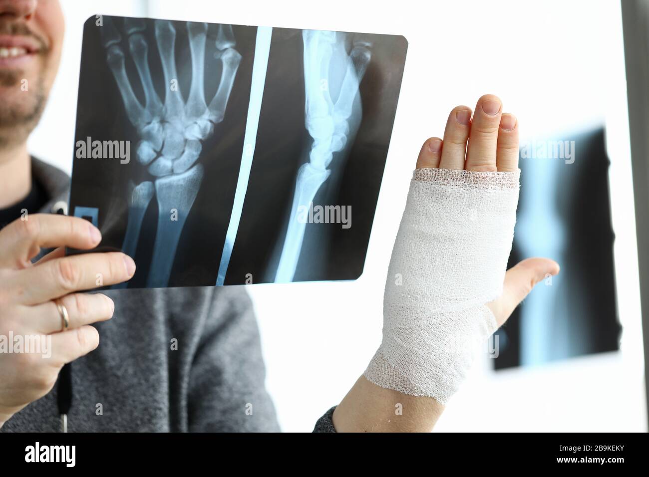 Male patient hold in hand CT scan of his broken arm Stock Photo - Alamy