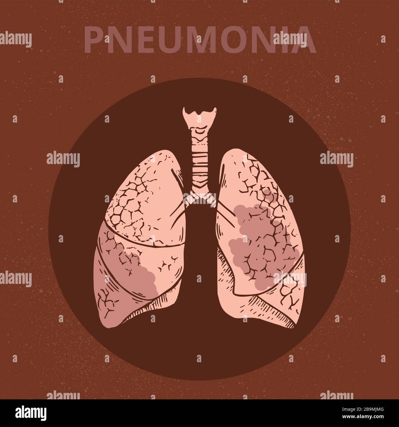 A schematic illustration of the human body with an infographic of the ...
