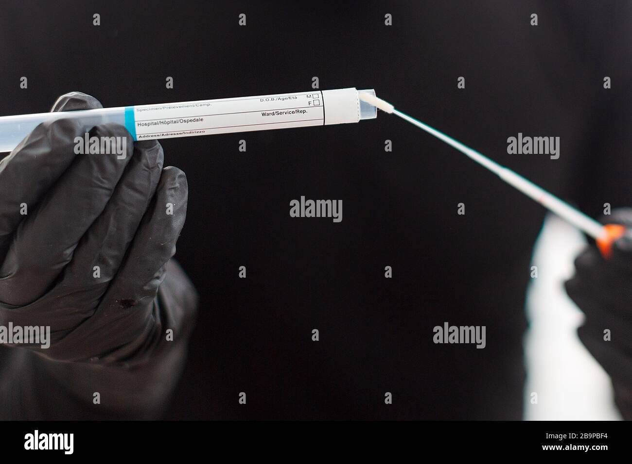 Sample sputum container hi-res stock photography and images - Alamy