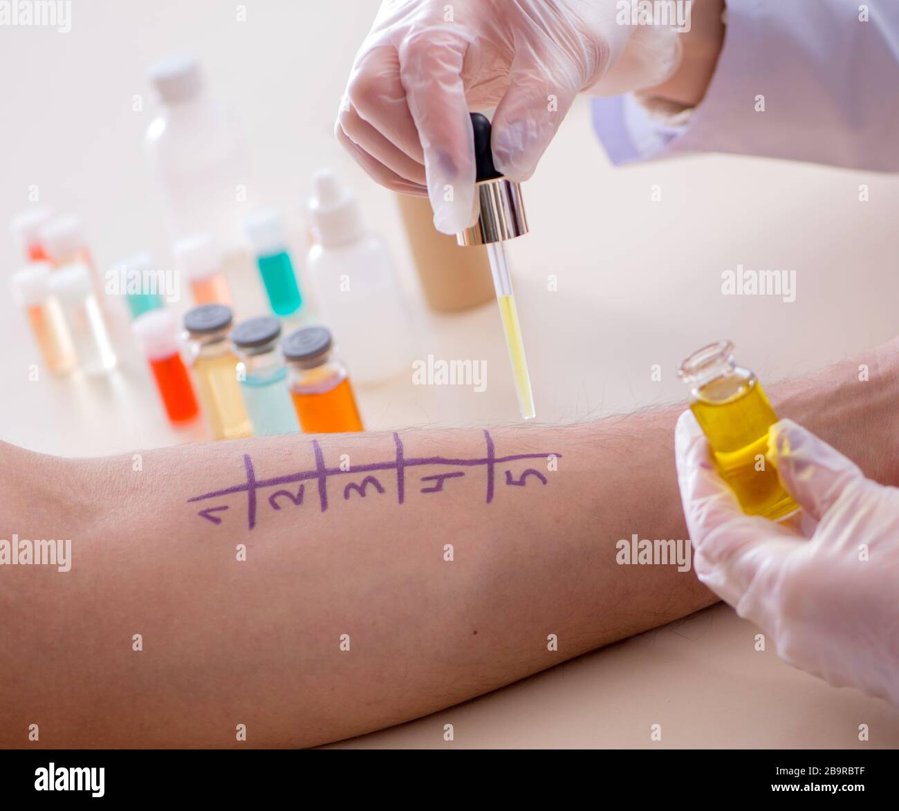 The doctor testing allergy reaction of patient in hospital Stock Photo ...