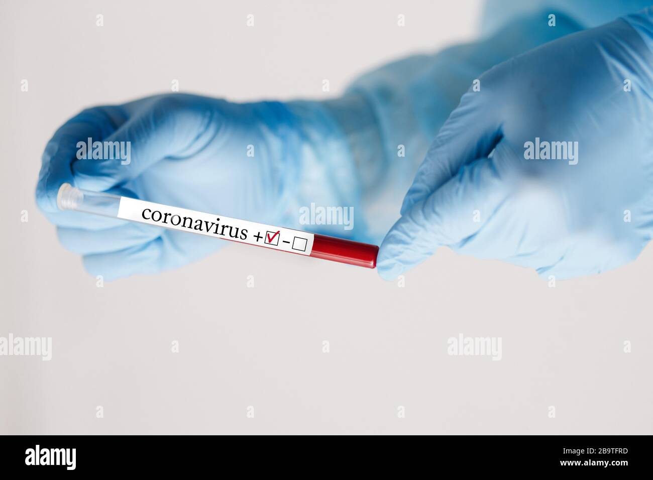 Close up of doctor hand holding blood sample. Medical equipment. Blood ...