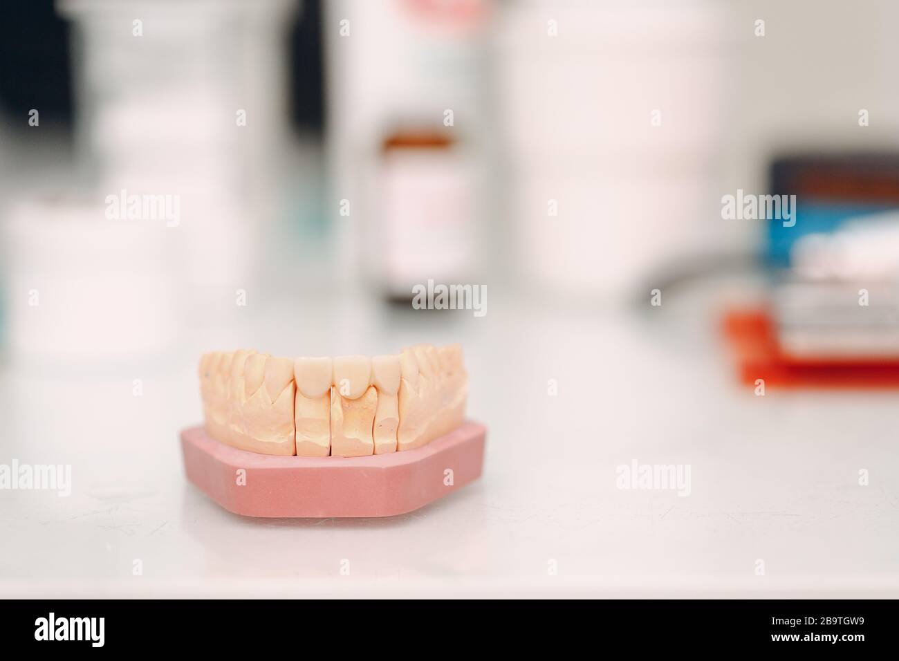 Dental layout of the human jaw with teeth and implants Stock Photo - Alamy