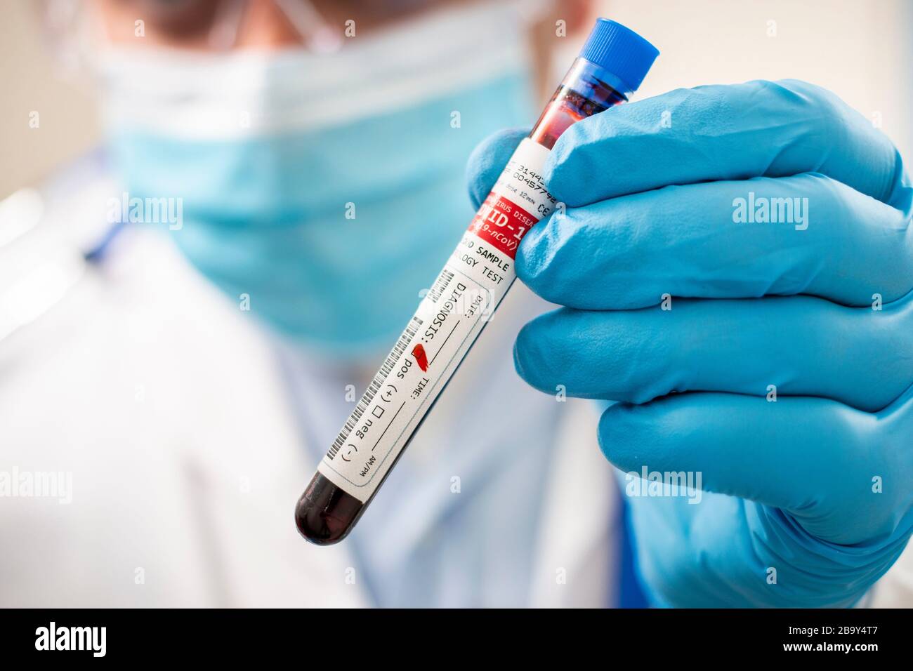 View of a doctor holding a fictional test tube blood sample, infected ...